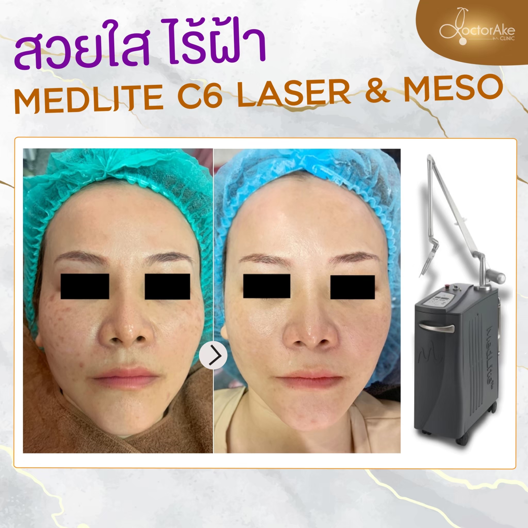 Medlite C6 Laser - doctorakeclinic