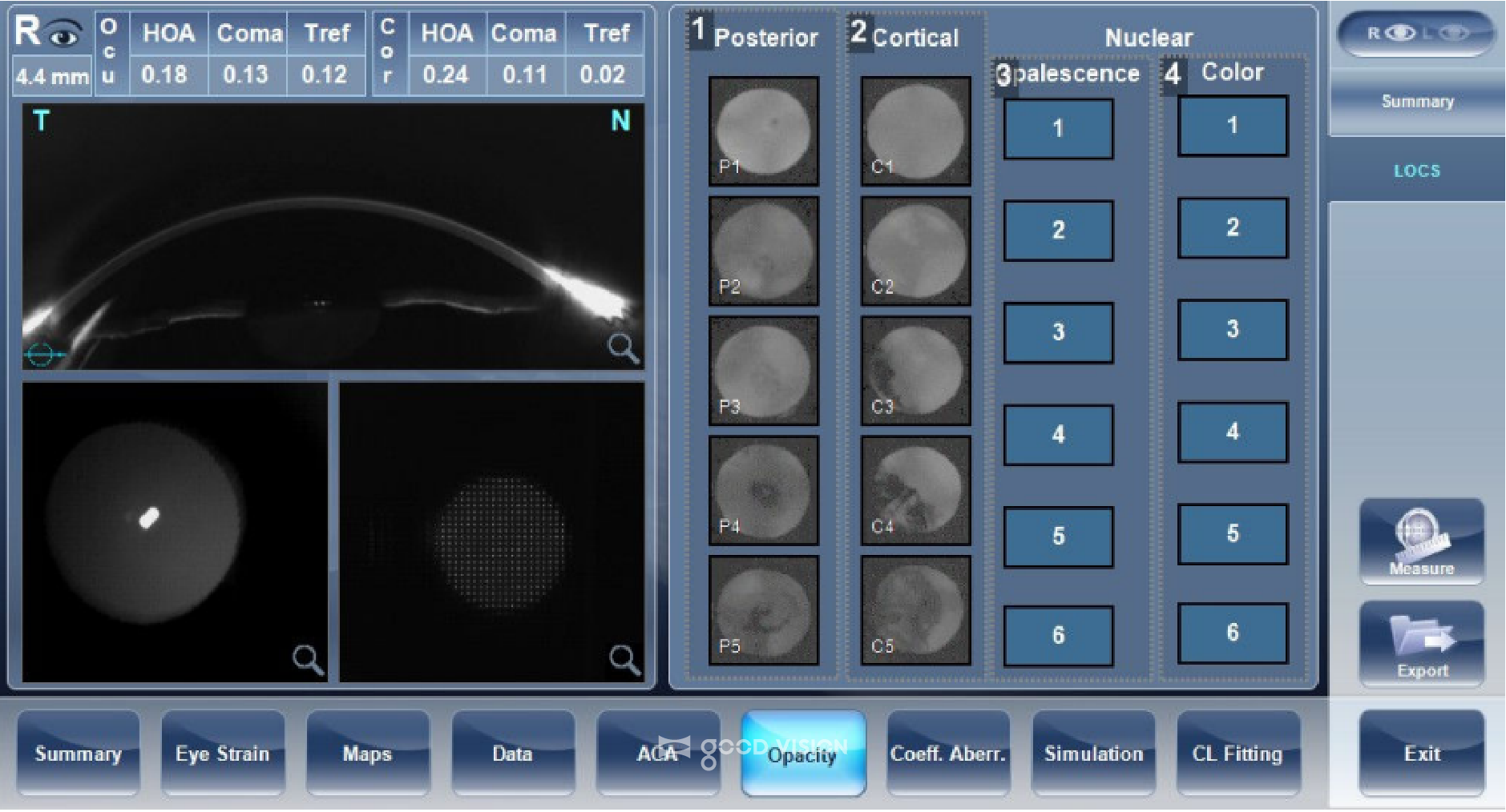 WAM 800 - The All in One Automated System for Comprehensive Refraction ...