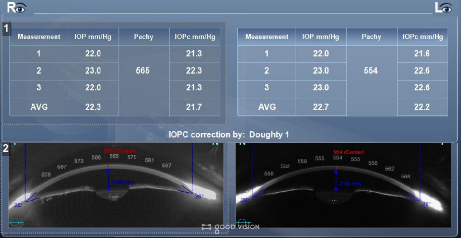 WAM 800 - The All in One Automated System for Comprehensive Refraction ...