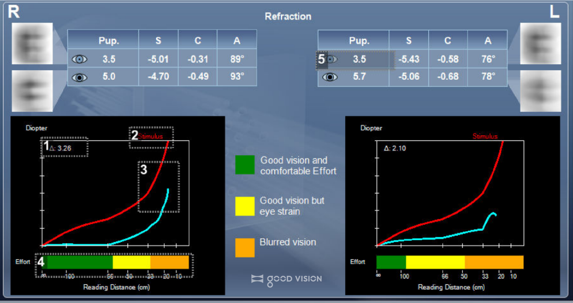 WAM 800 - The All in One Automated System for Comprehensive Refraction ...