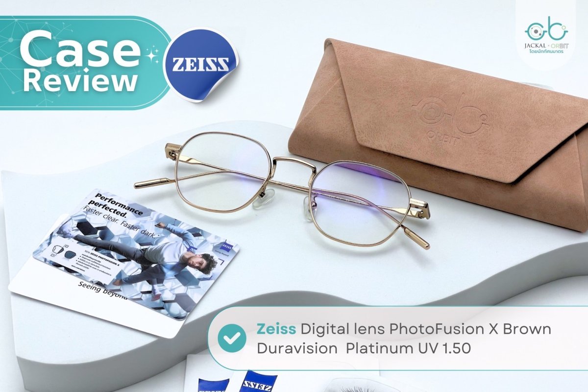 Case review เคสคุณศิริรัตน์ โดยร้านแว่นตา Jackal x Orbit โดยนักทัศนมาตร ...