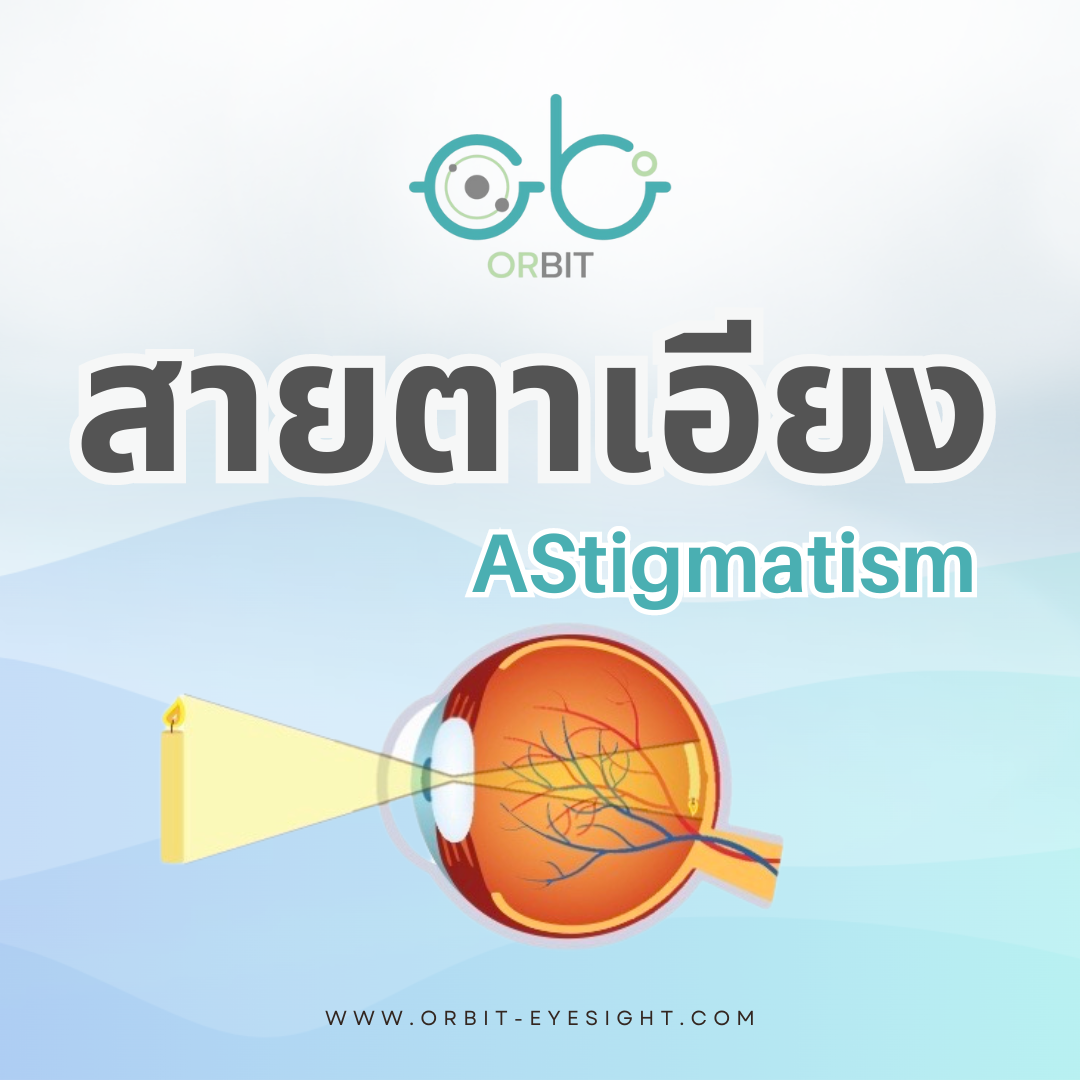 รู้ทันปัญหาสายตาเอียง (AStigmatism) - orbit-eyesight