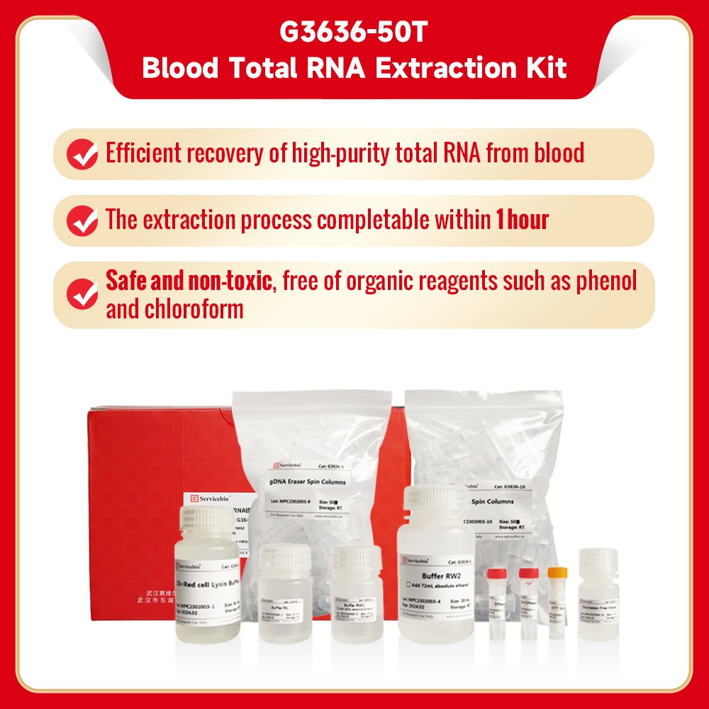 Blood Total RNA Purification Kit, 50 T (for Nucleic Acid Extraction) - smartscience