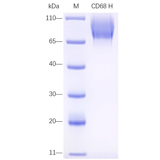 Recombinant Human CD68 Protein (His-tag)