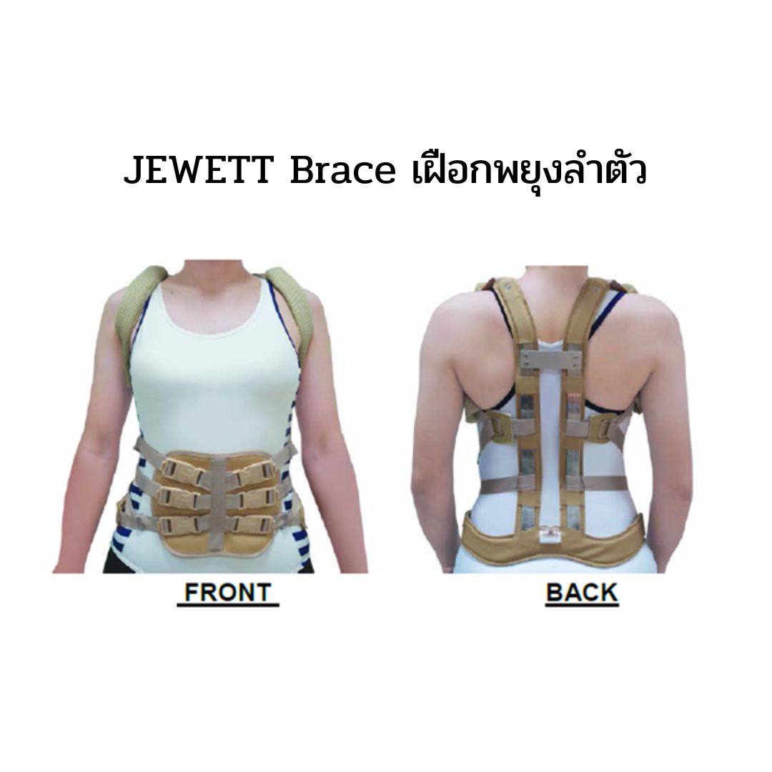 Jewett Brace / เฝือกพยุงลำตัว - jetmt
