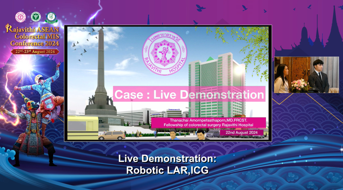 VDO Rerun Rajavithi ASEAN Colorectal Minimal Invasive Surgery Conference 2024 - pmdrj