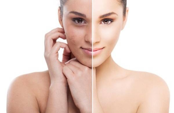 ดูแลผิวอย่างไรดี หลังเล่นน้ำสงกรานต์