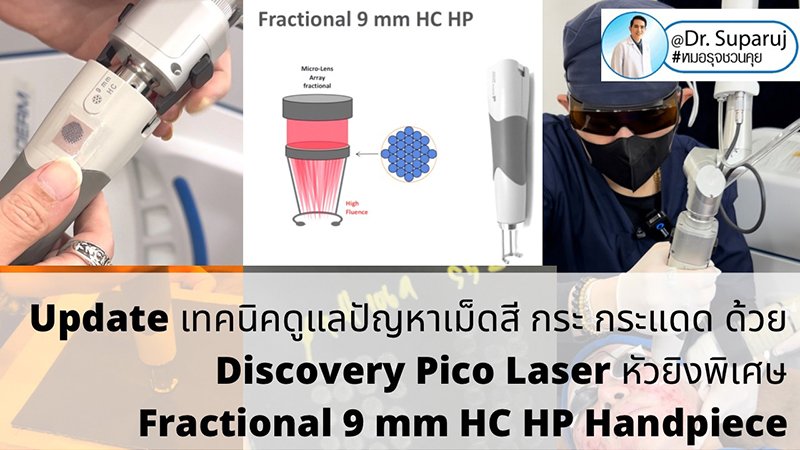 Update เทคนิคดูแลปัญหาเม็ดสี กระ กระแดด ด้วย Discovery Pico Laser หัว ...