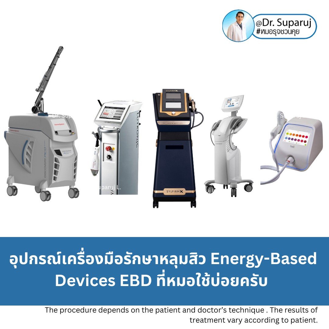 Update Energy-based Devices EBD อุปกรณ์เครื่องมือ ที่มีให้การดูแลรักษา ...