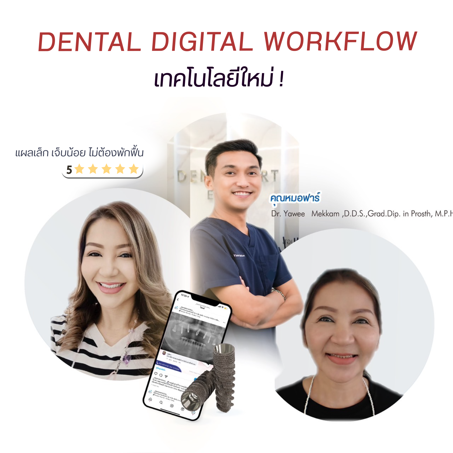 ศูนย์รากฟันเทียม จัดฟันฟันใส invisalign Dental Art Elite