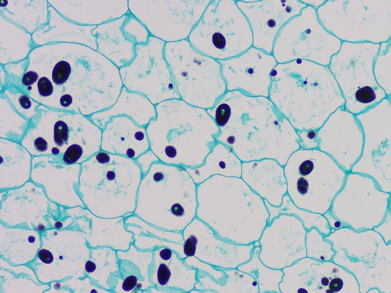 Iodine-Potassium Iodide Dye Solution, 50 mL×2 (for Plant sample staining)