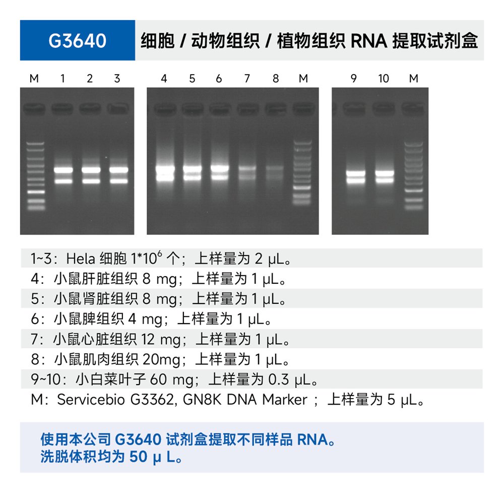 Animal Tissue/Cell Total RNA Extraction Kit, 50 T (for Nucleic Acid ...